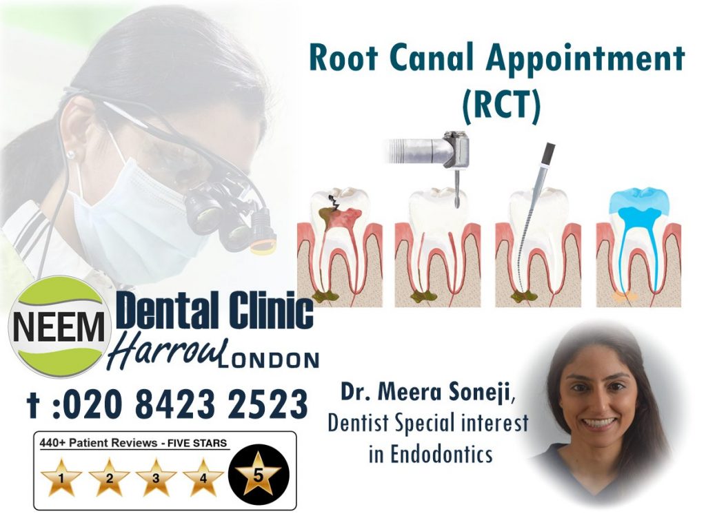 Best Endodontics – Root Canal Treatments in Harrow, North West London ...